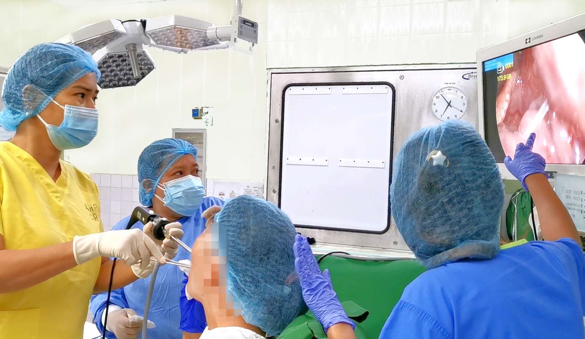 Busting Fishbone Ingestion Myths: Why you should not eat large bananas ...